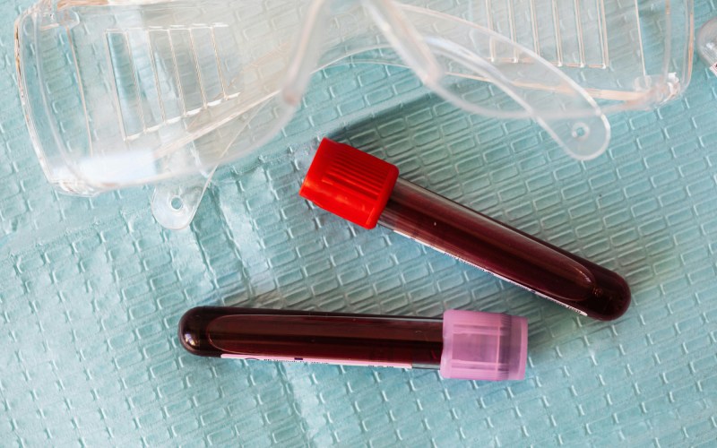 This $3 Blood Test Is Revolutionary in the Early Cancer Detection ...
